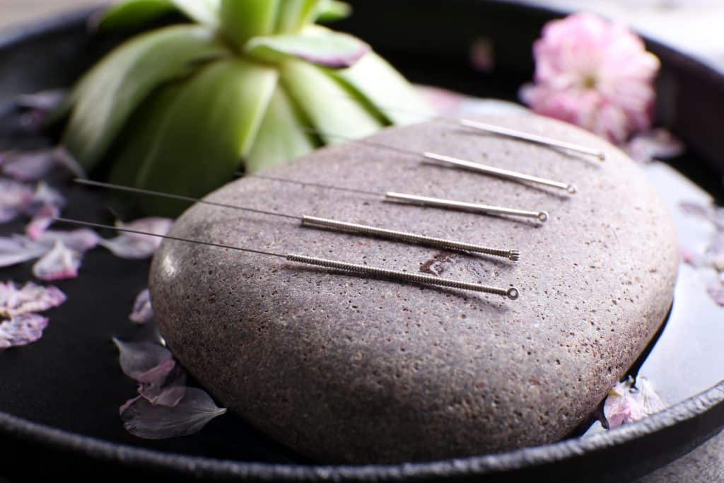 5 Steps to End Chronic Pain with Acupuncture in Long Island